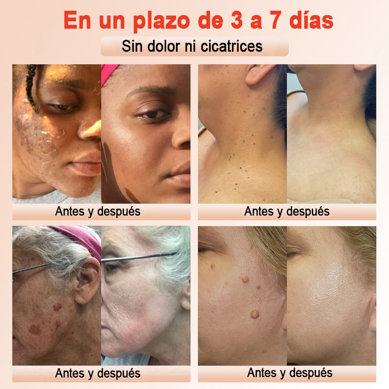 Jorondy™ | Gel Aclarante y despigmentante 🌟 – Outlet Prime